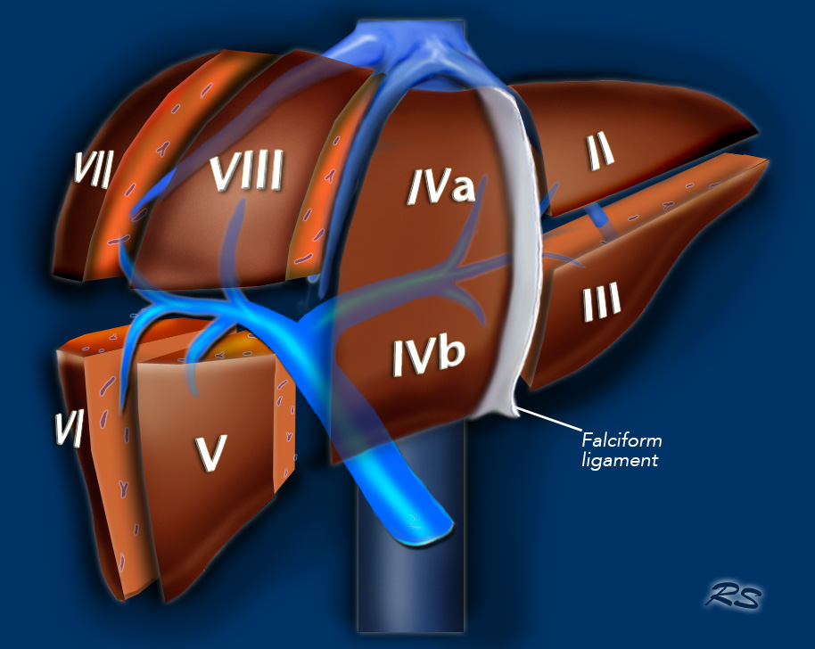 The Radiology Assistant : Liver - Segmental Anatomy
