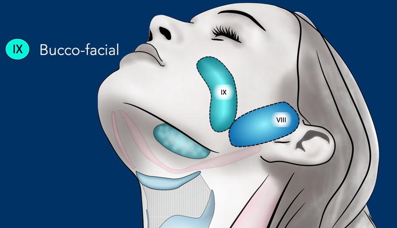 The Radiology Assistant : Cervical Lymph Node Map