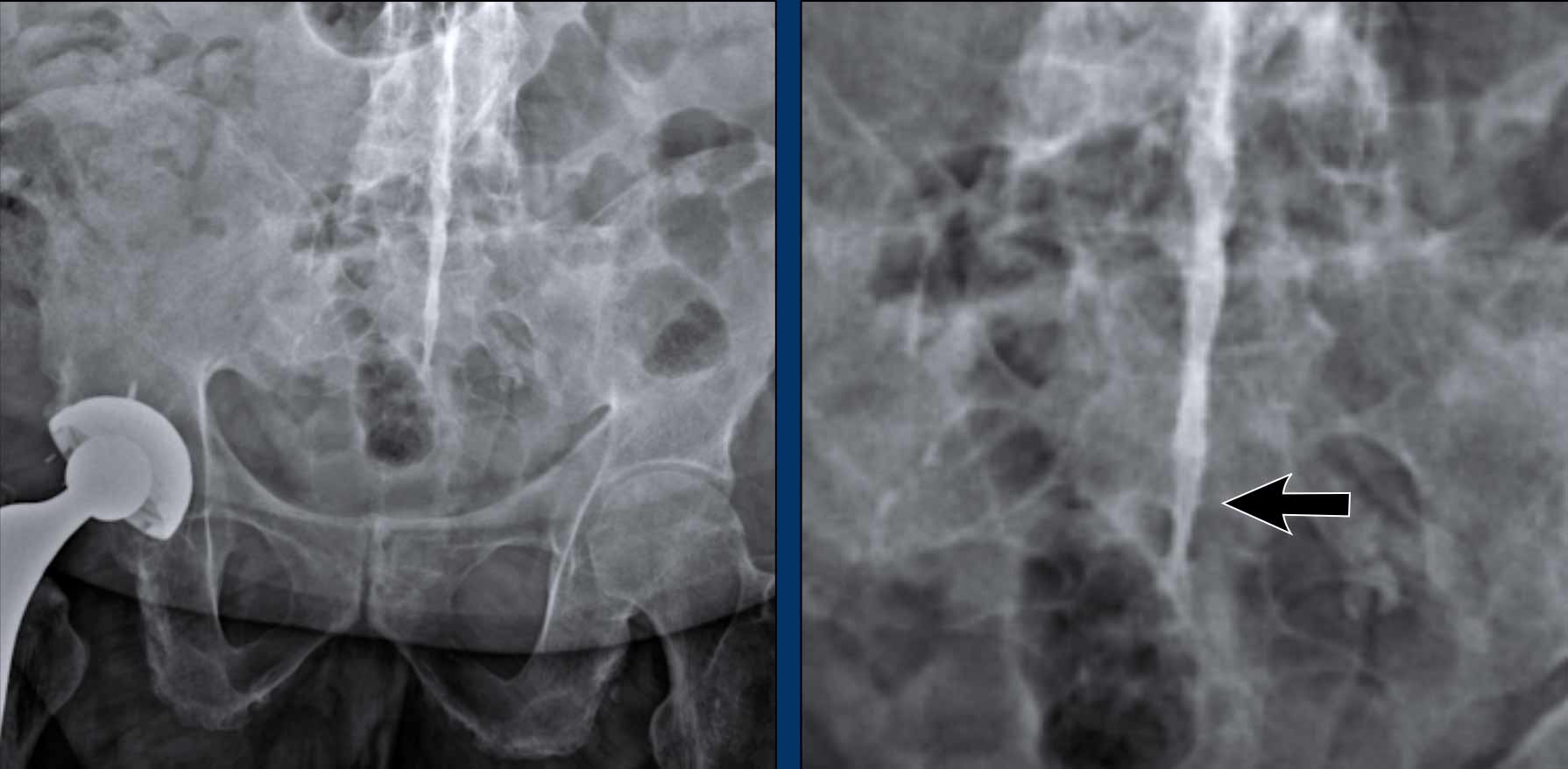 The Radiology Assistant : Arthritis