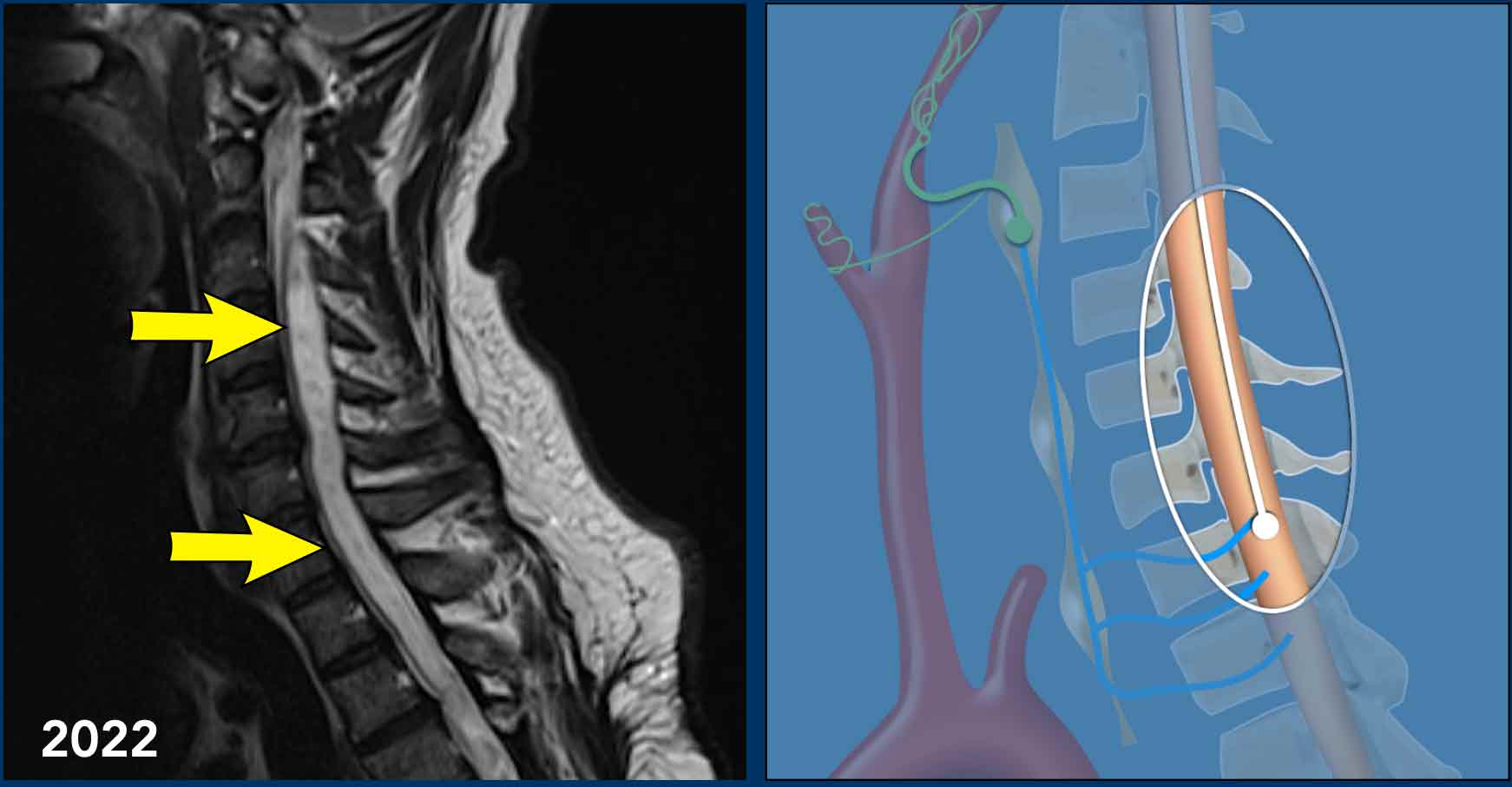 The Radiology Assistant : Horner syndrome.