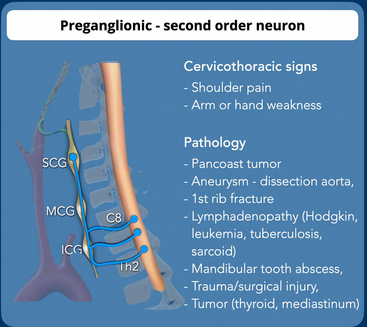 The Radiology Assistant : Horner syndrome.