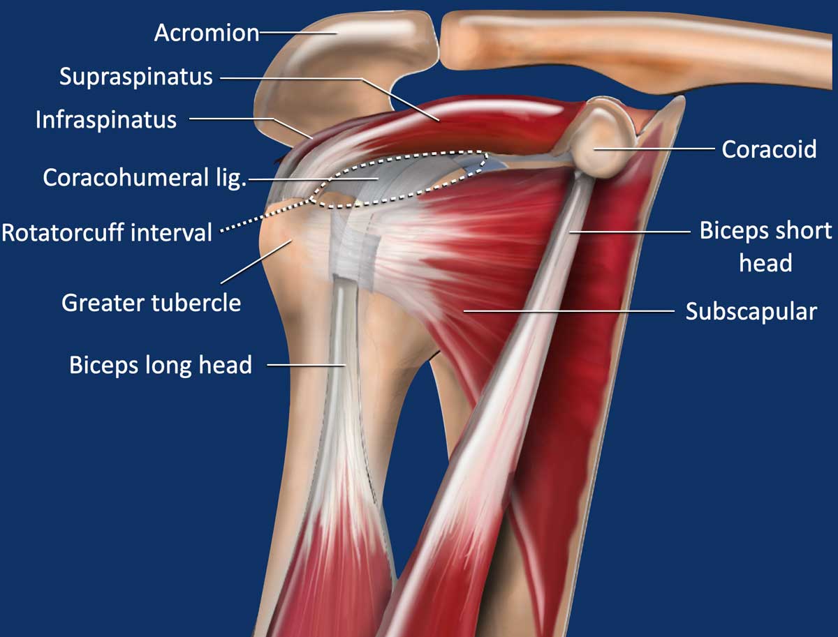 The Radiology Assistant : Shoulder Ultrasound