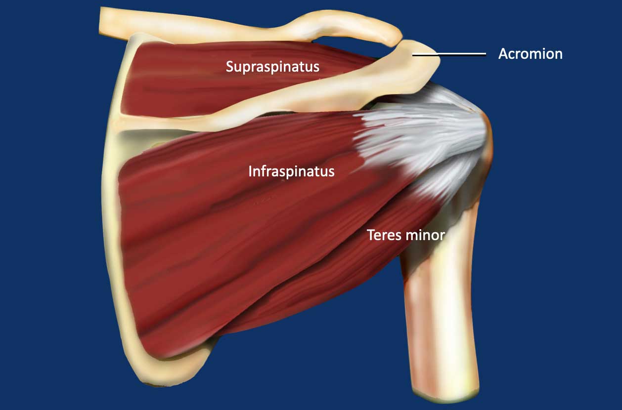 The Radiology Assistant : Shoulder Ultrasound