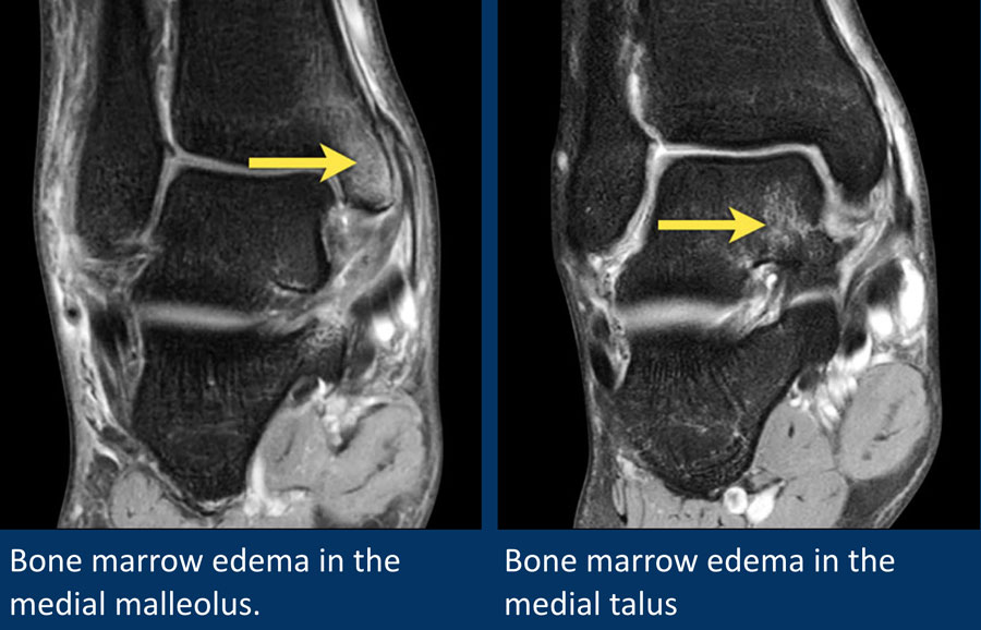 The Radiology Assistant Ankle MRI Examination
