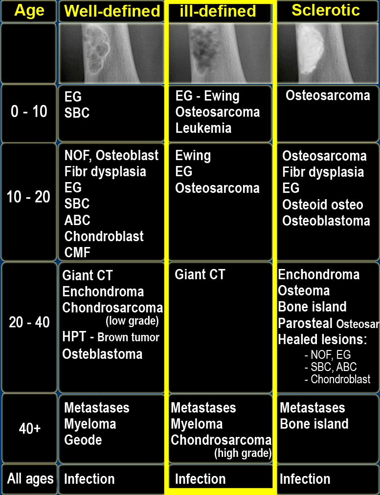 The Radiology Assistant Bone Tumor Osteolytic Tumors And Tumor like