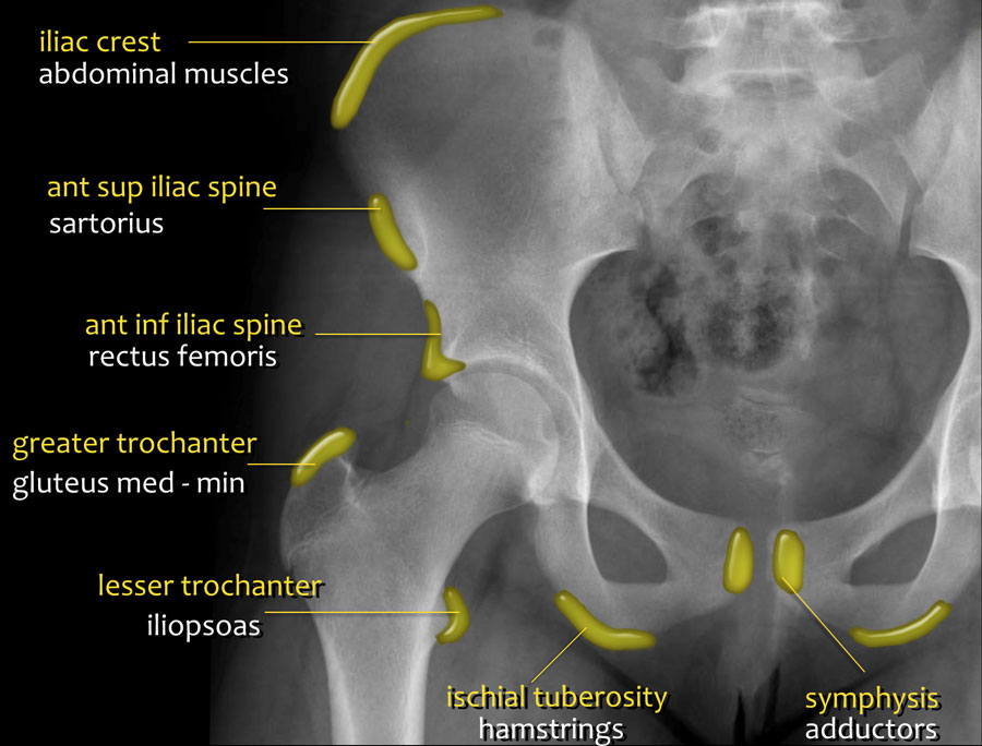 Hip Muscle Anatomy Mri Hip Muscle Anatomy Mri