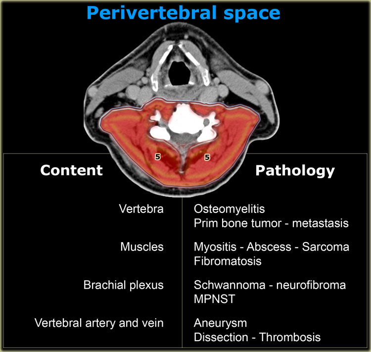 The Radiology Assistant : Anatomy and Pathology