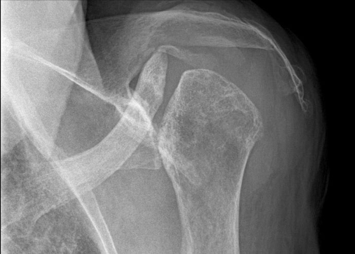 The Radiology Assistant : Arthritis