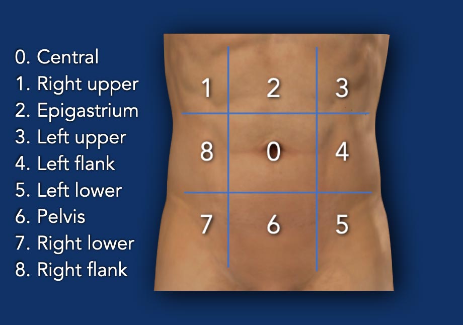 The Radiology Assistant : Peritoneal Carcinomatosis