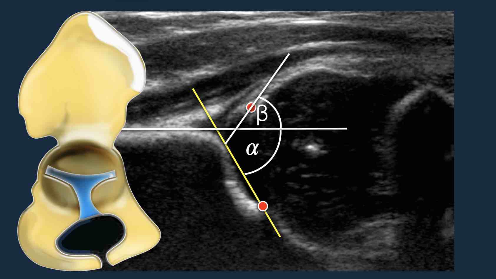 The Radiology Assistant : Video-Lectures