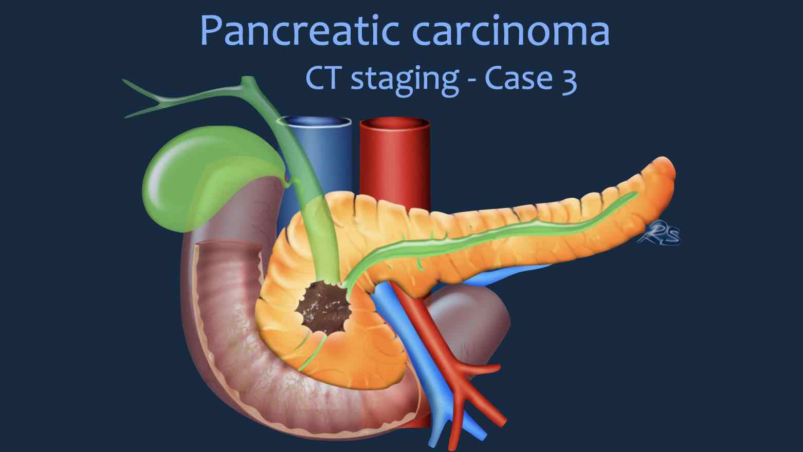 The Radiology Assistant : Video-Lectures