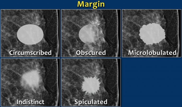 The Radiology Assistant : Bi-RADS for Mammography and Ultrasound 2013