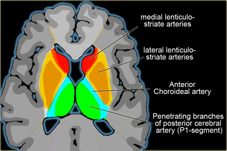 The Radiology Assistant : Vascular territories of the Brain