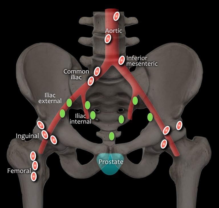 The Radiology Assistant : Prostate Anatomy