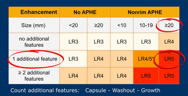 The Radiology Assistant : LI-RADS
