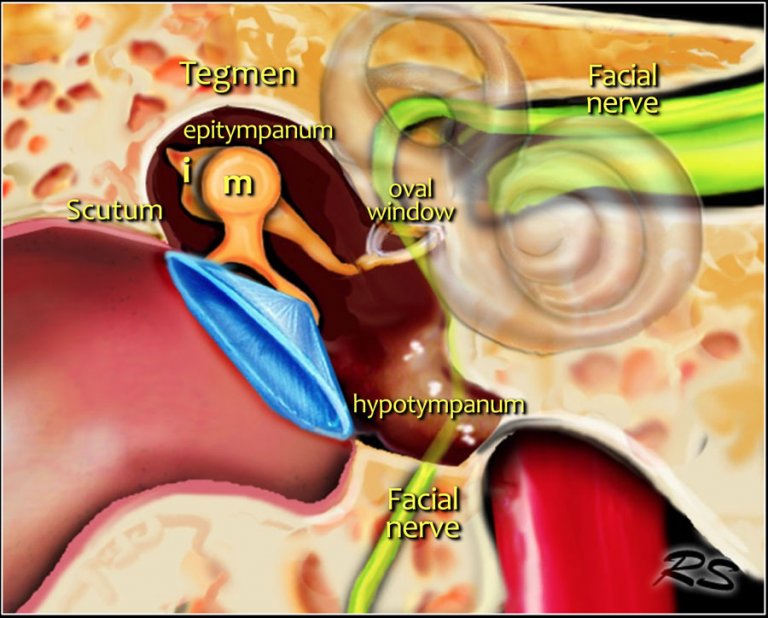 The Radiology Assistant : Temporal Bone Anatomy 2.0